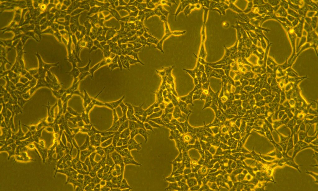 Natural Products In Drug Discovery Advances And Opportunities