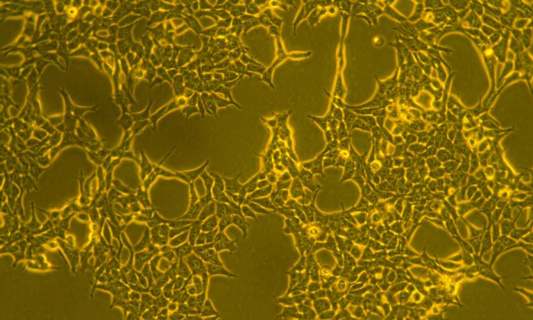 Natural products in drug discovery: advances and opportunities ...